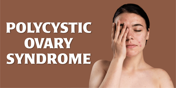 Polycystic Ovary Syndrome – Causes, Symptoms, and Treatment